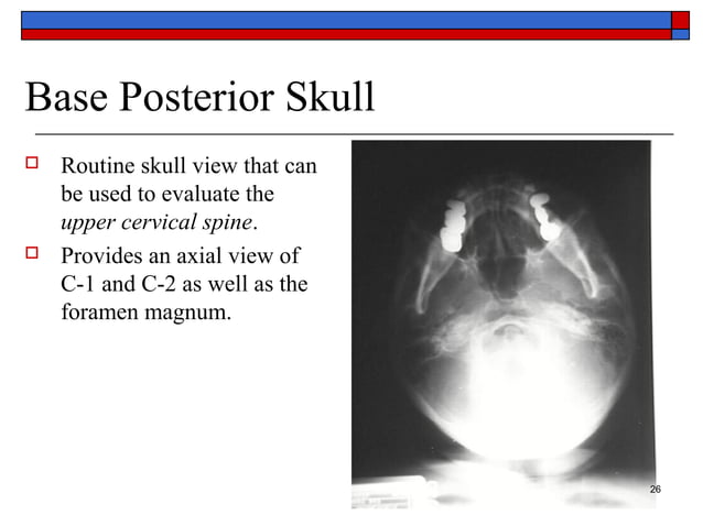 Basic anatomy Views -importance and positioning Interpretation Skull ...