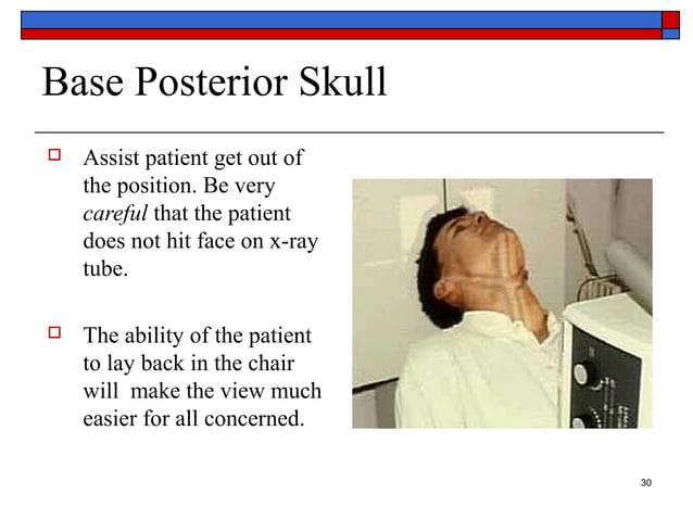 Basic anatomy Views -importance and positioning Interpretation Skull ...