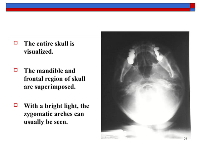Basic anatomy Views -importance and positioning Interpretation Skull ...