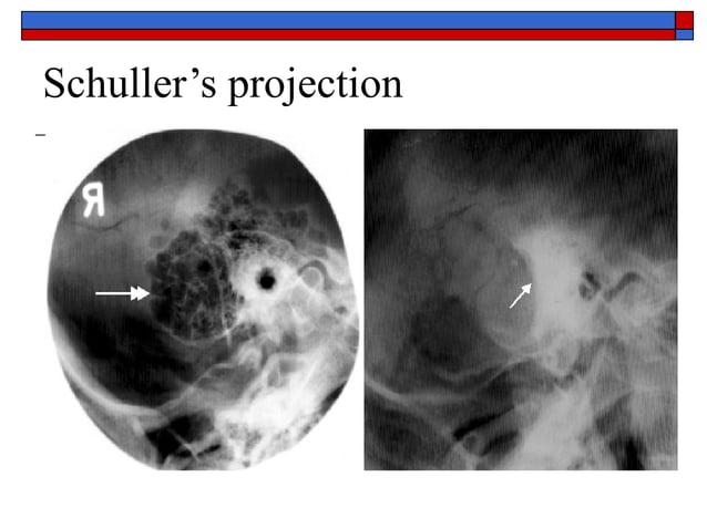 Basic anatomy Views -importance and positioning Interpretation Skull ...