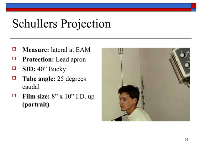 Basic anatomy Views -importance and positioning Interpretation Skull ...