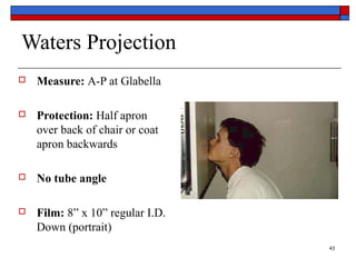 Basic anatomy Views -importance and positioning Interpretation Skull ...