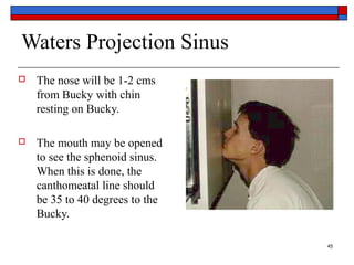 Basic anatomy Views -importance and positioning Interpretation Skull ...
