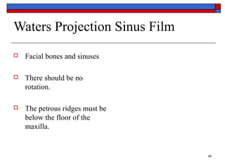 Basic anatomy Views -importance and positioning Interpretation Skull ...