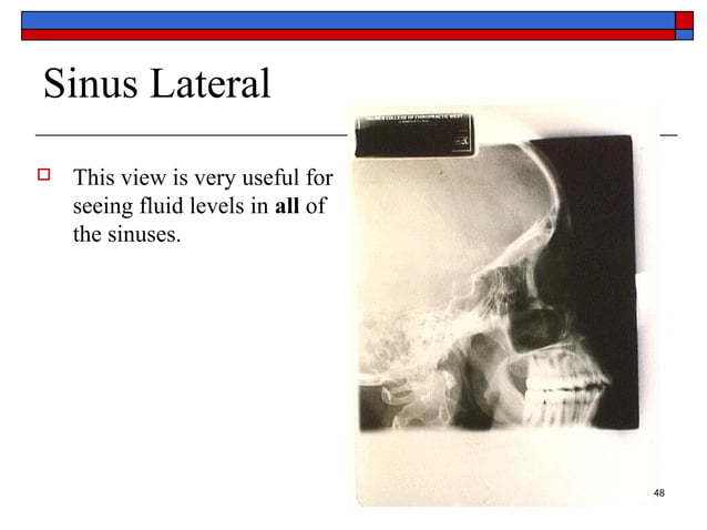 Basic anatomy Views -importance and positioning Interpretation Skull ...