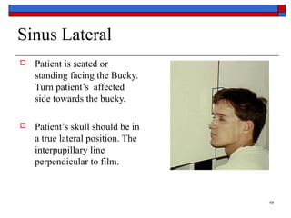 Basic anatomy Views -importance and positioning Interpretation Skull ...