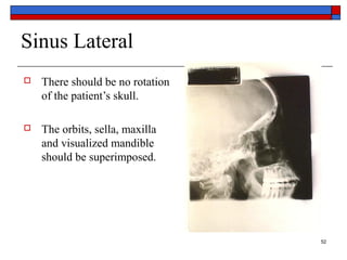 Basic anatomy Views -importance and positioning Interpretation Skull ...