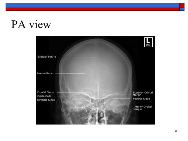 Basic anatomy Views -importance and positioning Interpretation Skull ...