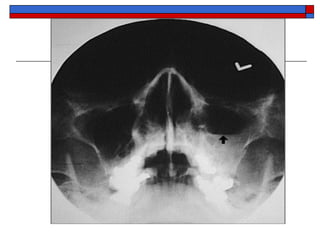 Basic anatomy Views -importance and positioning Interpretation Skull ...
