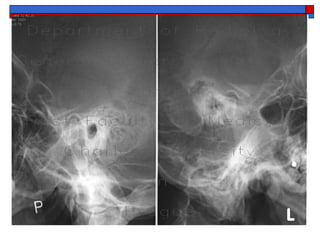 Basic anatomy Views -importance and positioning Interpretation Skull ...