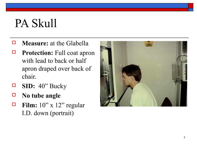 Basic anatomy Views -importance and positioning Interpretation Skull ...