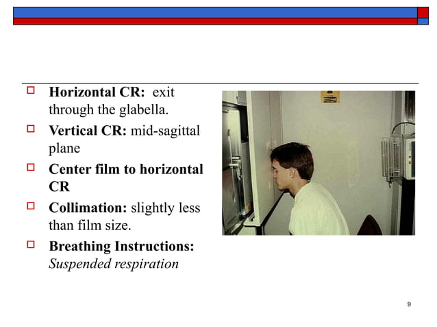 Basic anatomy Views -importance and positioning Interpretation Skull ...