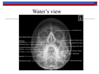 Basic anatomy Views -importance and positioning Interpretation Skull ...
