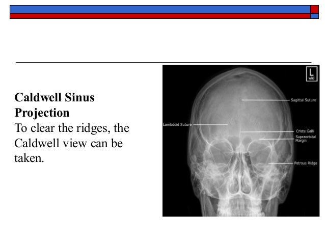 Basic anatomy Views -importance and positioning Interpretation Skull
