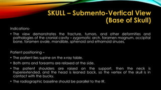 skull radiography - Ayush Gupta (BRT, MRIT) | PPTX