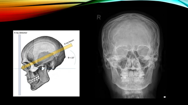 skull radiography - Ayush Gupta (BRT, MRIT) | PPT