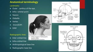 Skull radiography by sandesh Magar | PPTX