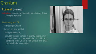 Skull radiography by sandesh Magar | PPTX