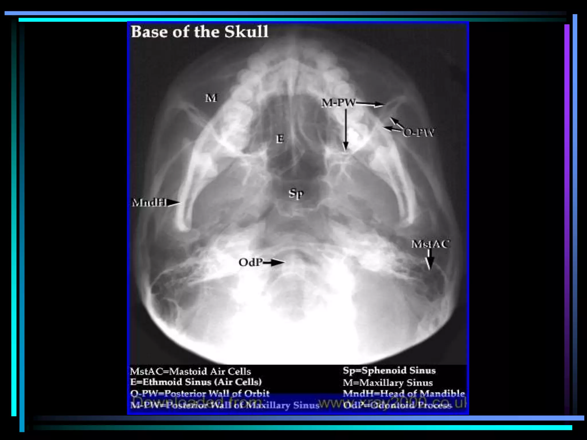 Skull radiography | PPTX