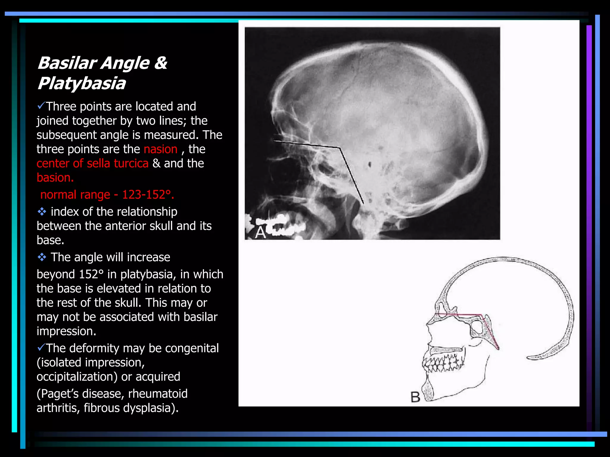 Skull radiography | PPTX