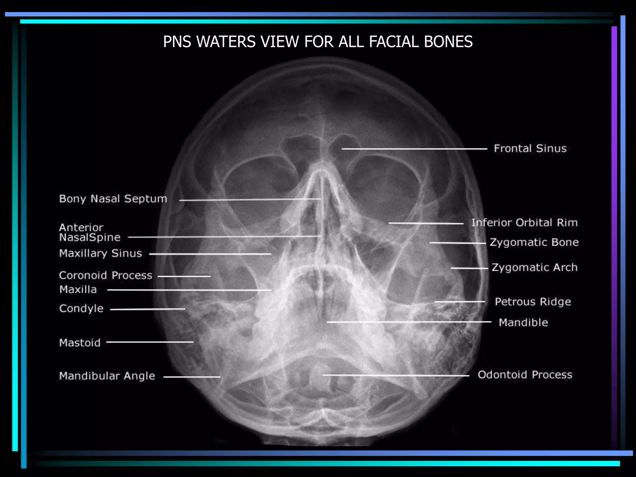 Skull radiography | PPTX