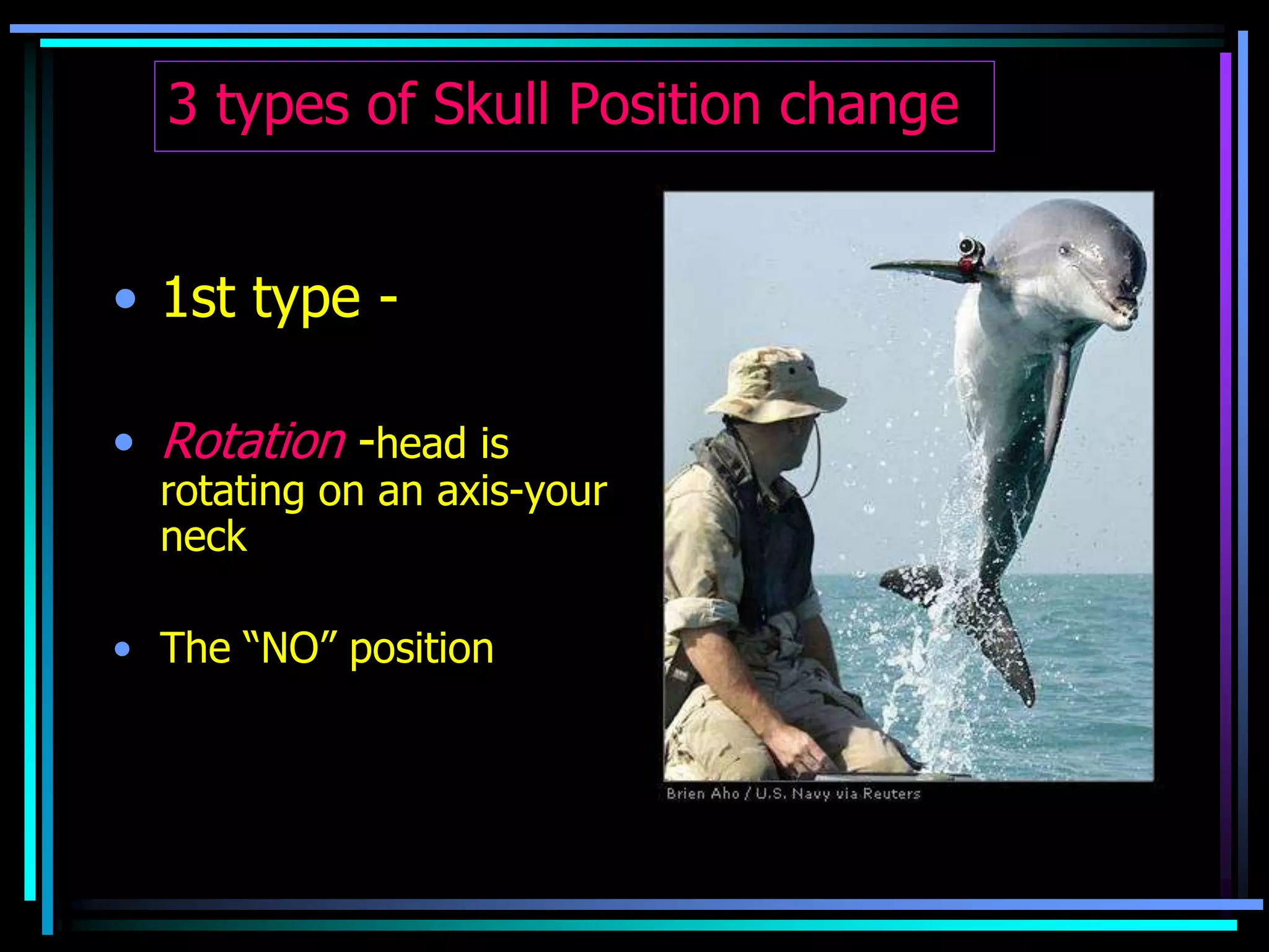 Skull radiography | PPTX