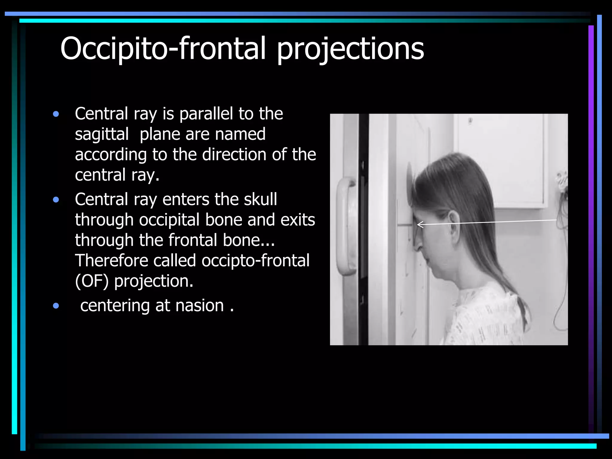 Skull radiography | PPTX