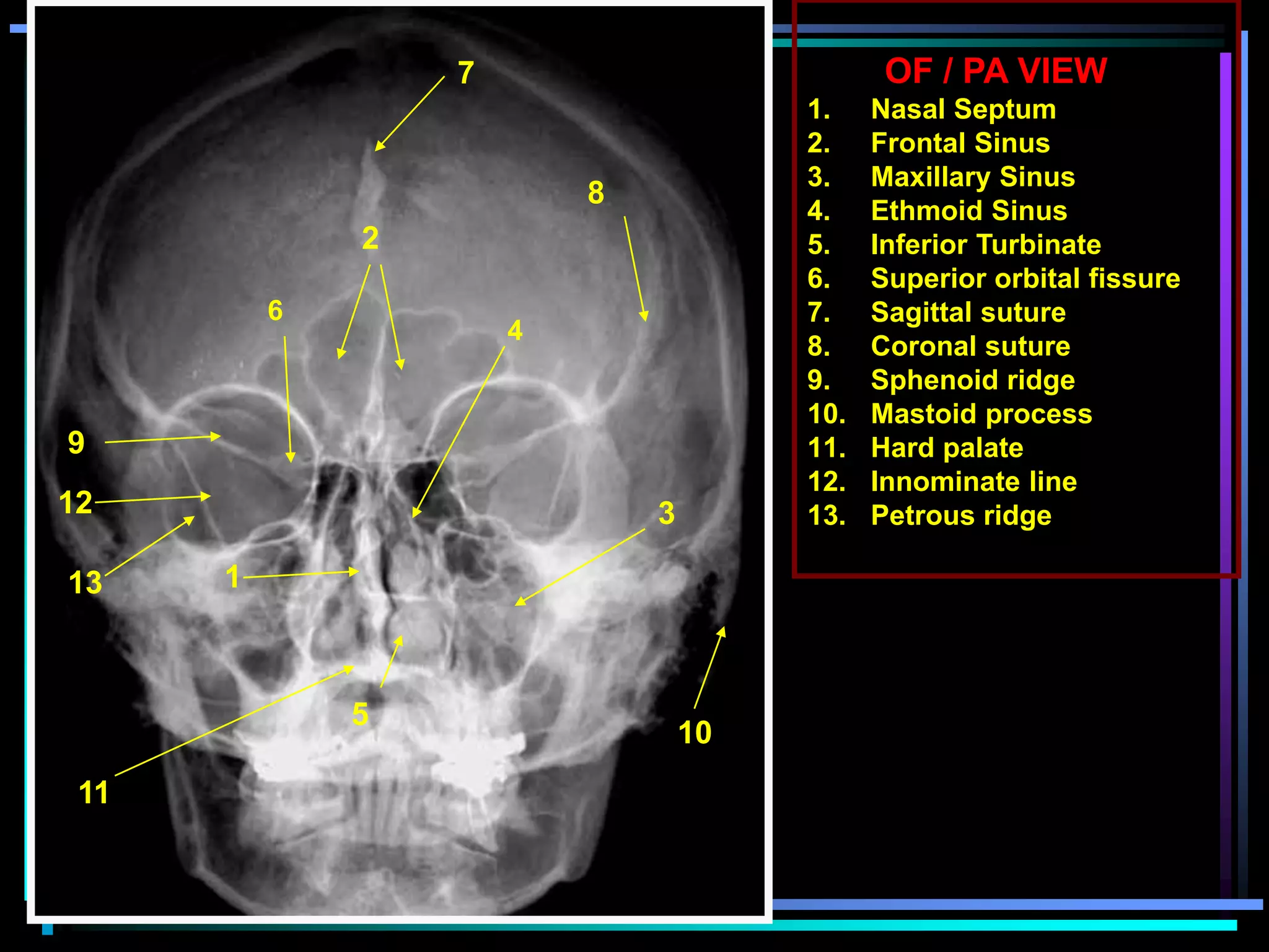 Skull radiography | PPTX