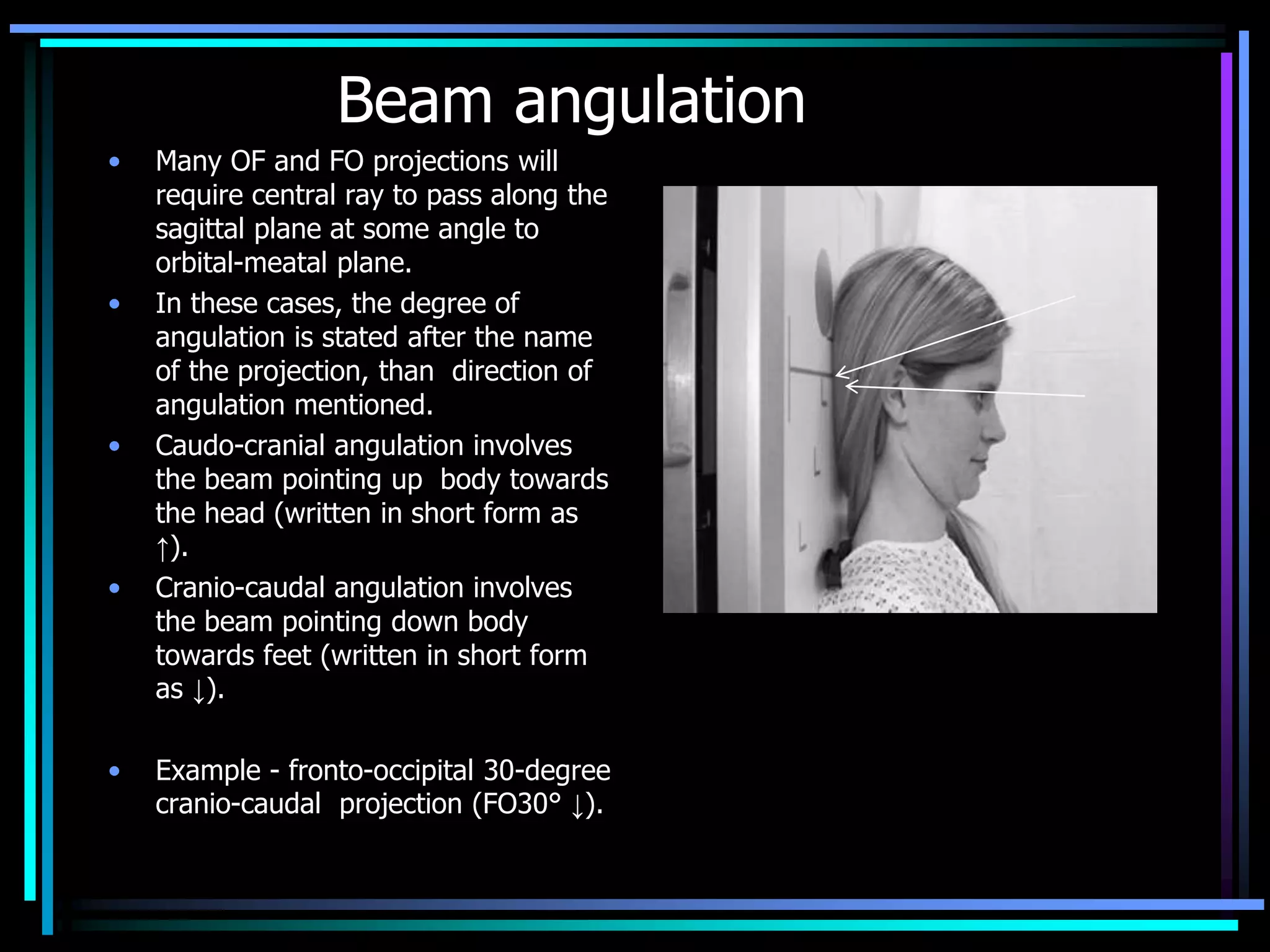 Skull radiography | PPTX