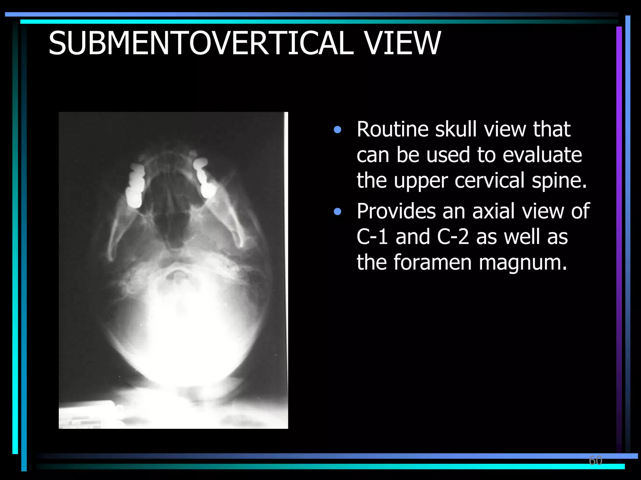 Skull radiography | PPTX