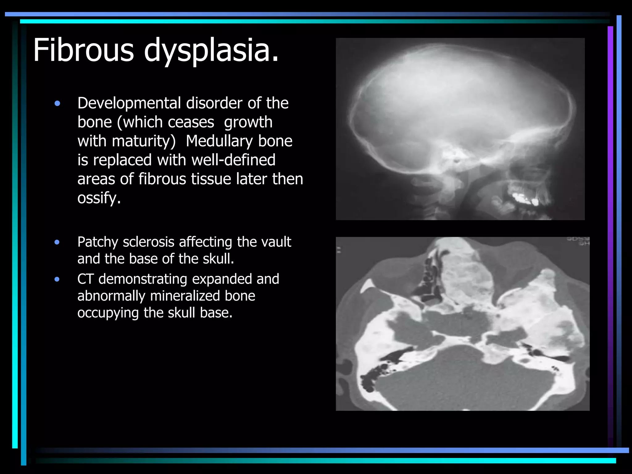 Skull radiography | PPTX