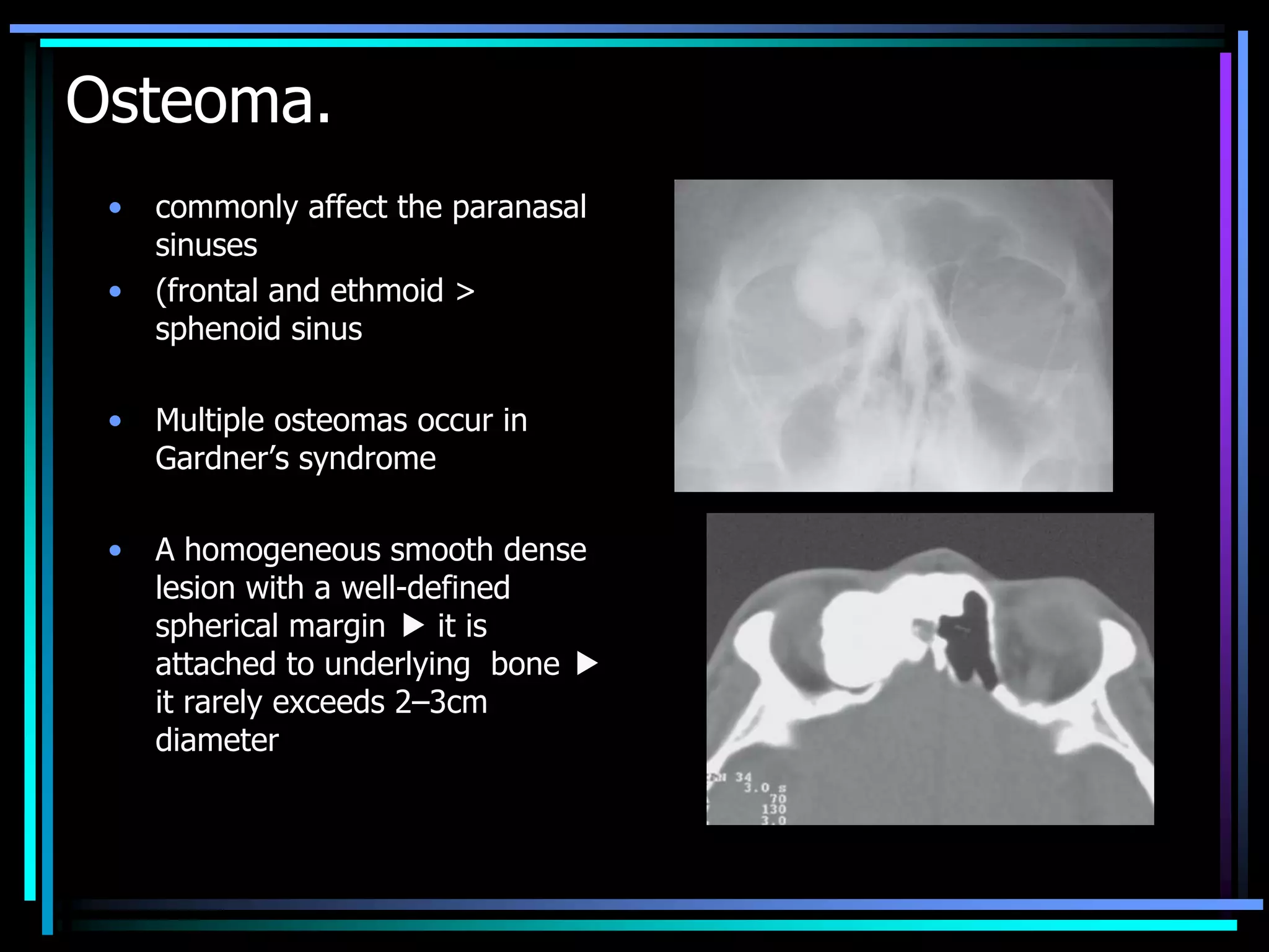 Skull radiography | PPTX