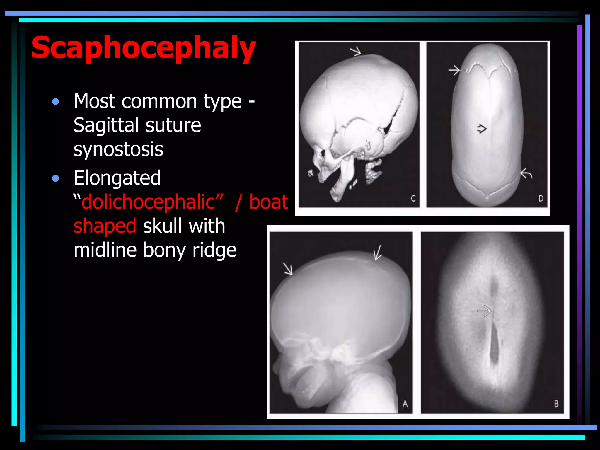 Skull radiography | PPTX