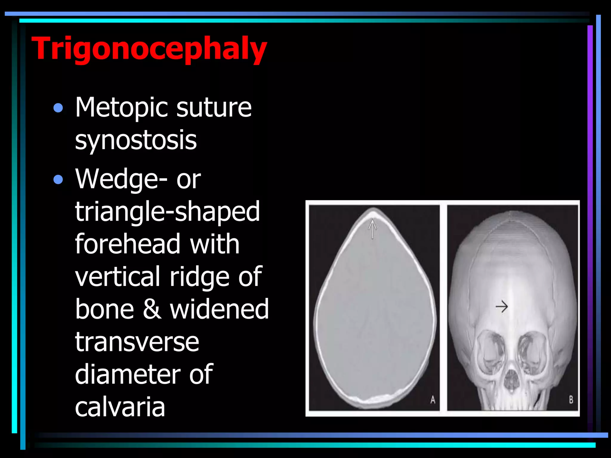 Skull radiography | PPTX