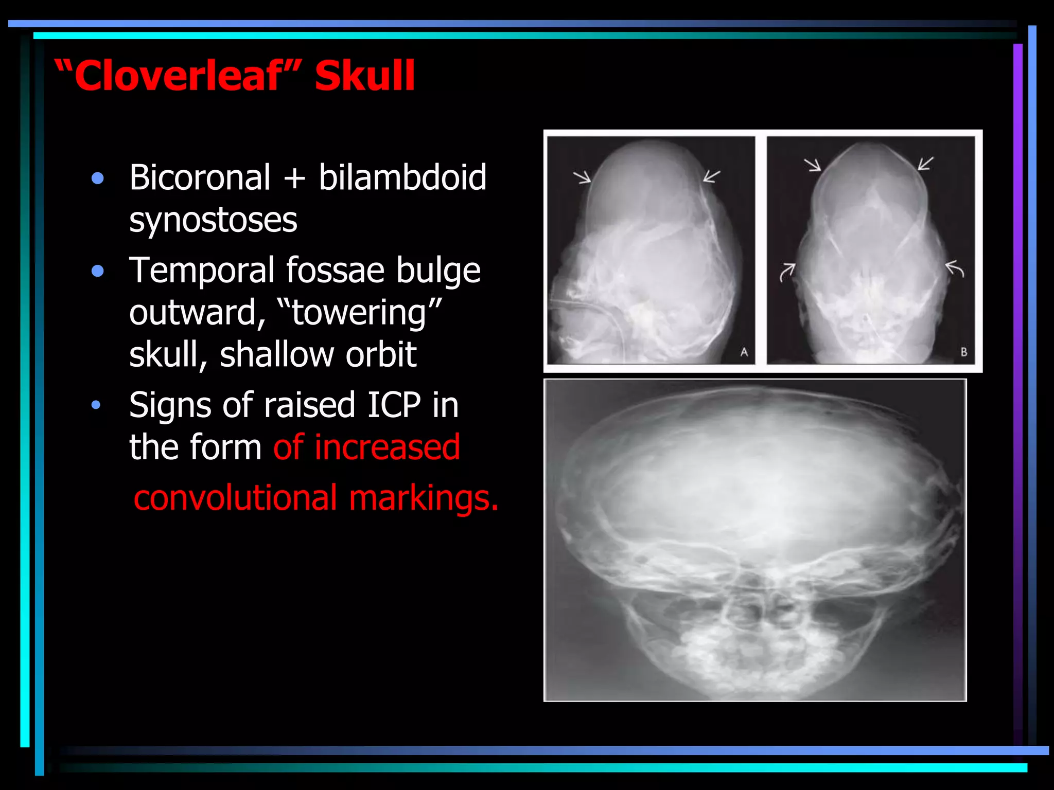 Skull radiography | PPTX