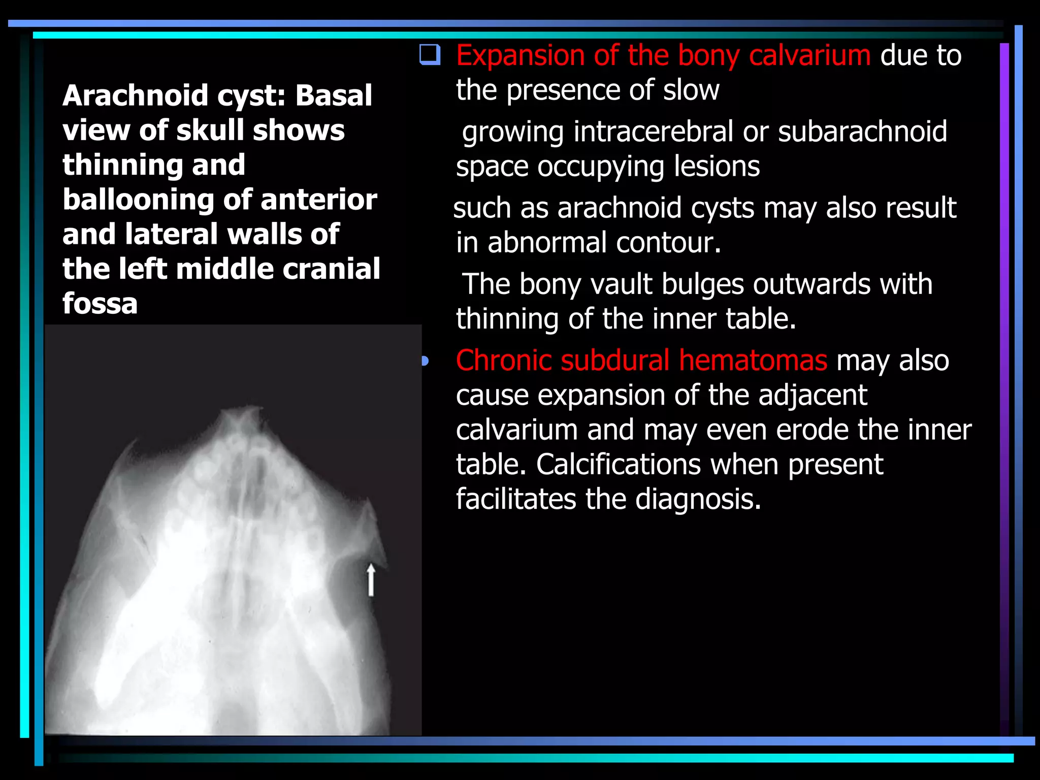 Skull radiography | PPTX