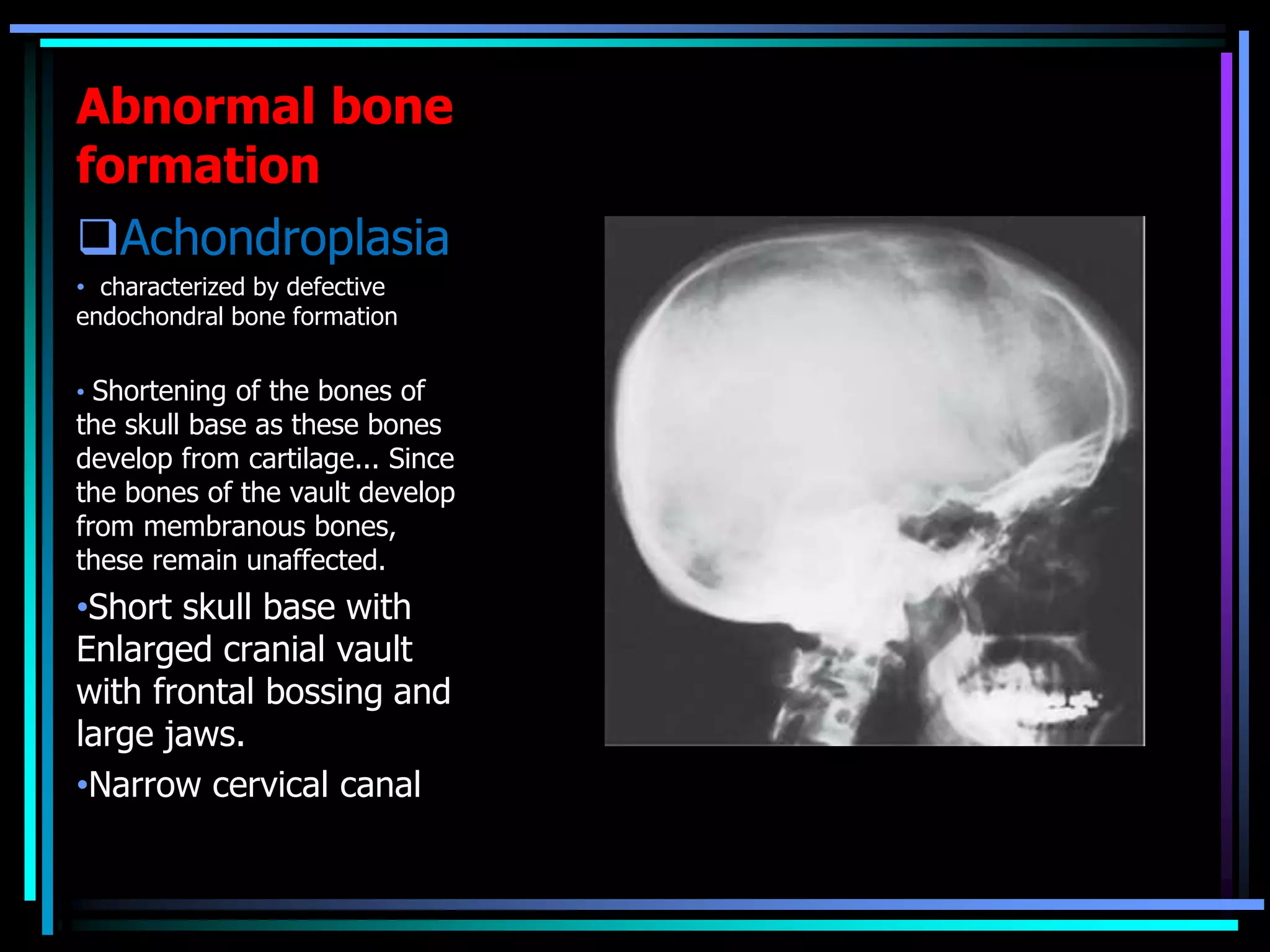 Skull radiography | PPTX