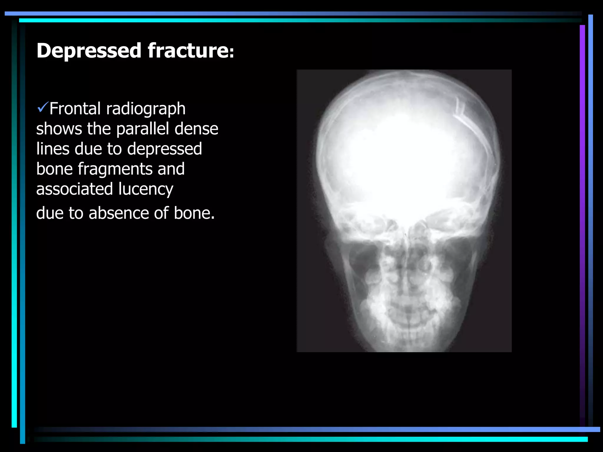 Skull radiography | PPTX