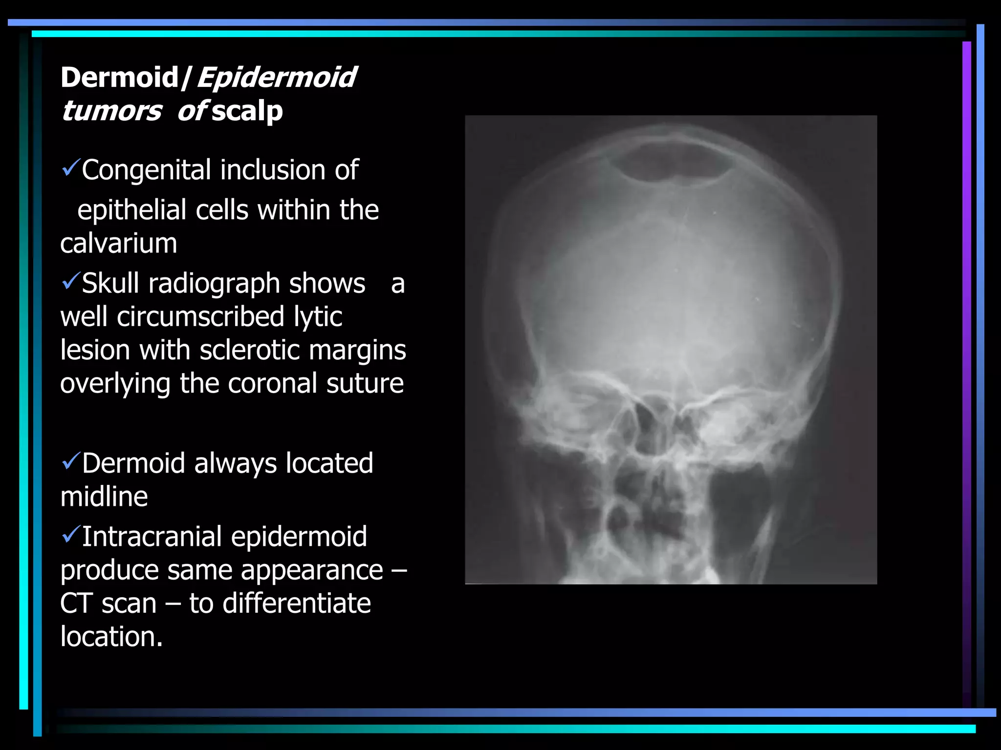 Skull radiography | PPTX