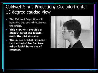 Skull radiography | PPTX