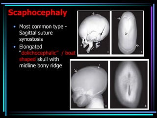 Skull radiography | PPTX