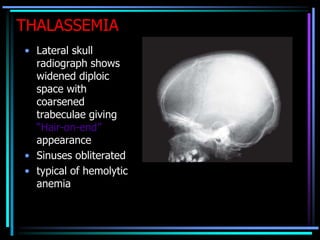 Skull radiography | PPT