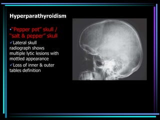 Skull radiography | PPT