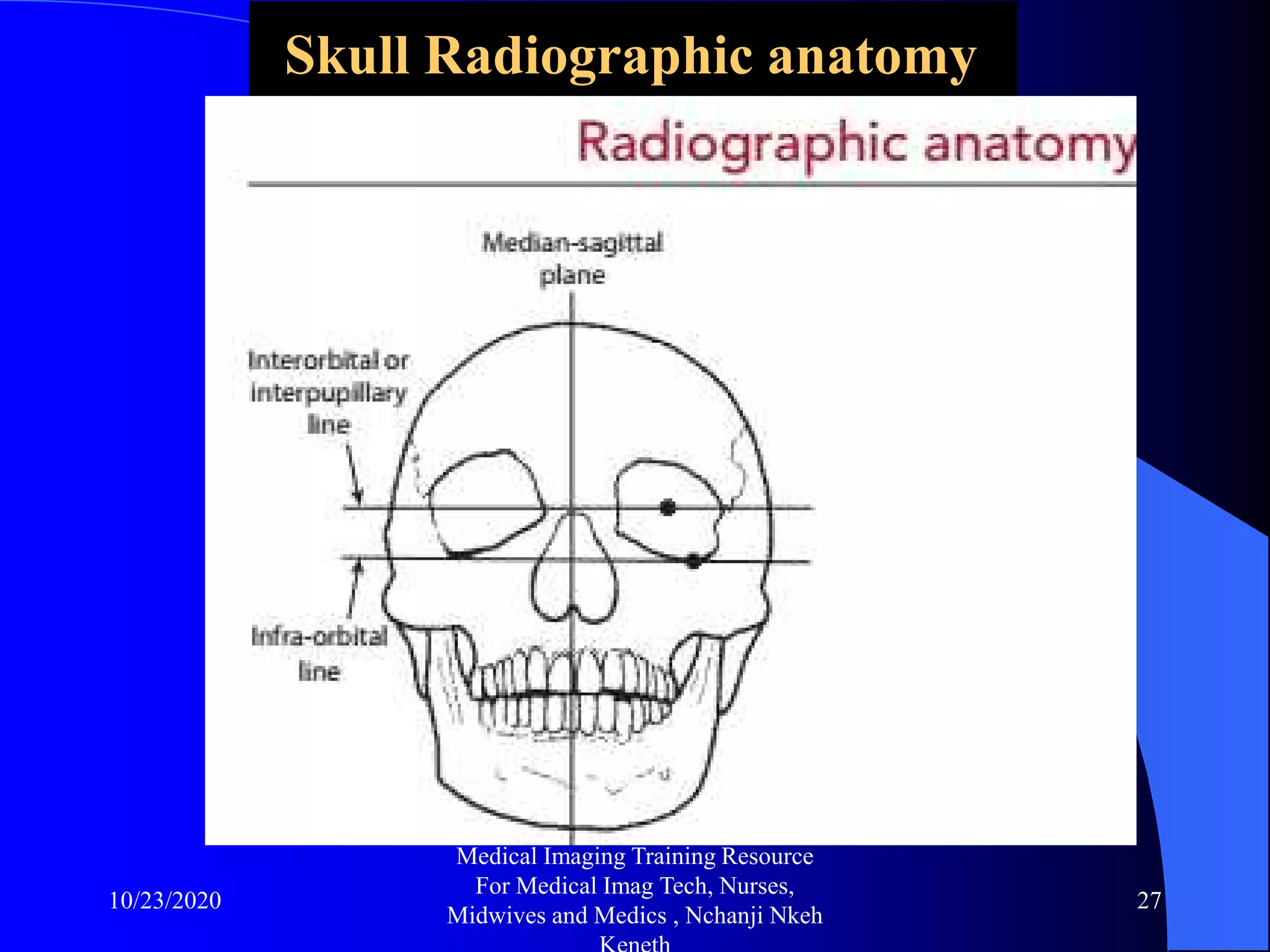 Skull x ray and pathologies radiology training resource nchanji nkeh ...