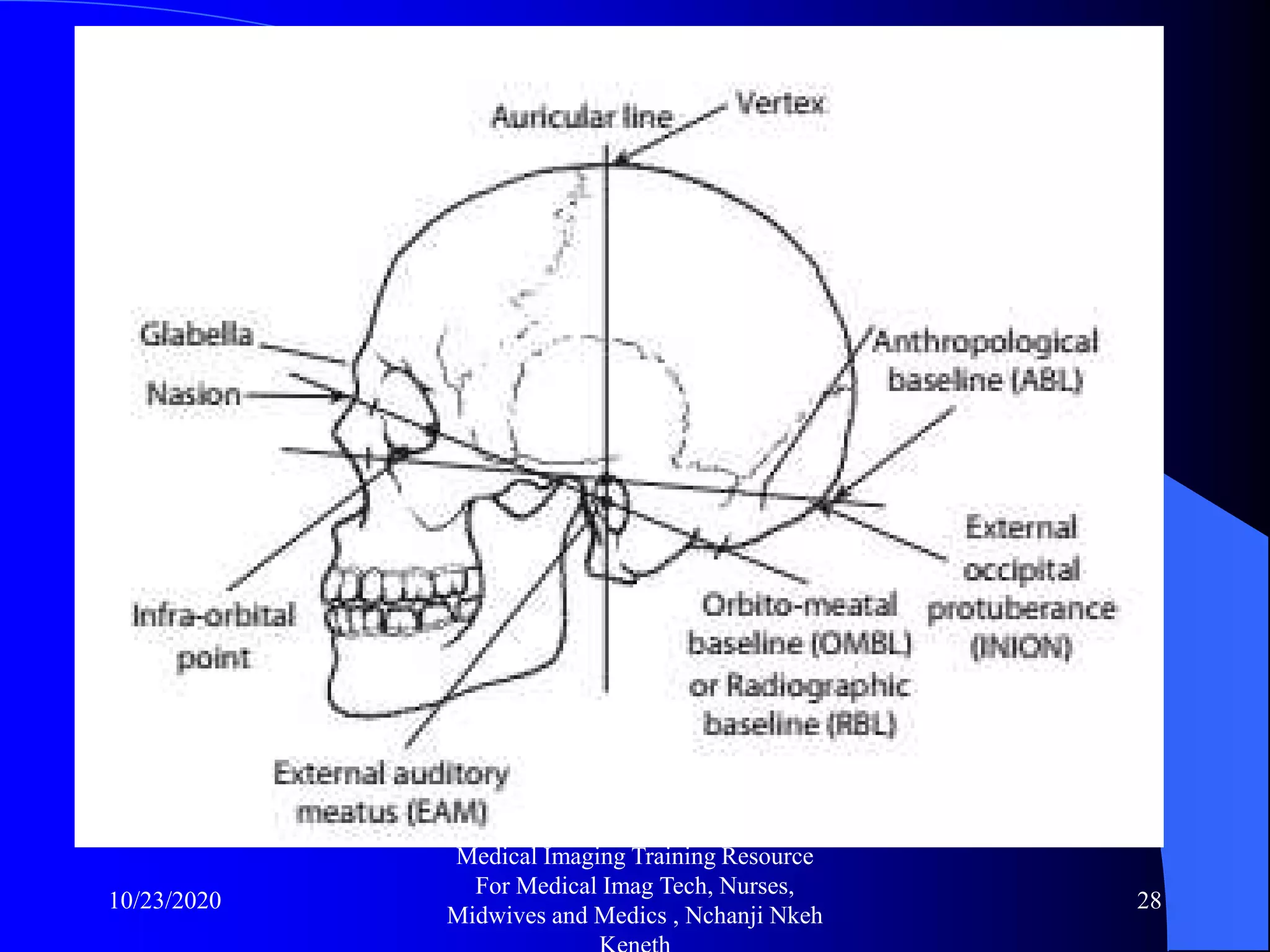 Skull x ray and pathologies radiology training resource nchanji nkeh ...