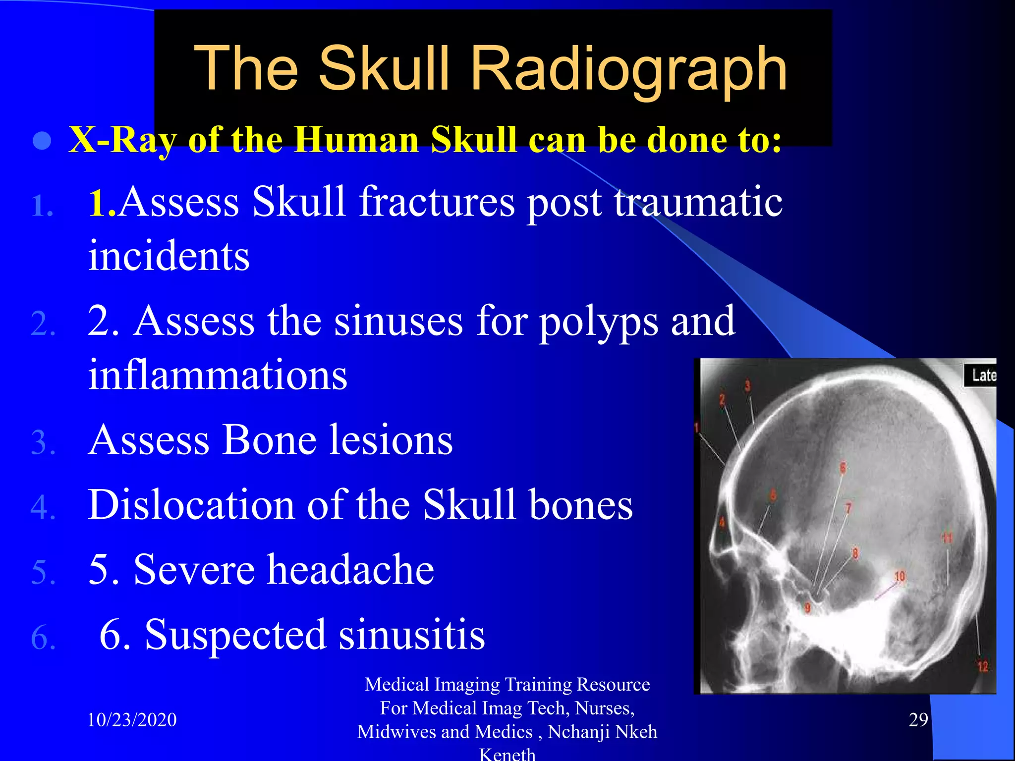 Skull x ray and pathologies radiology training resource nchanji nkeh ...