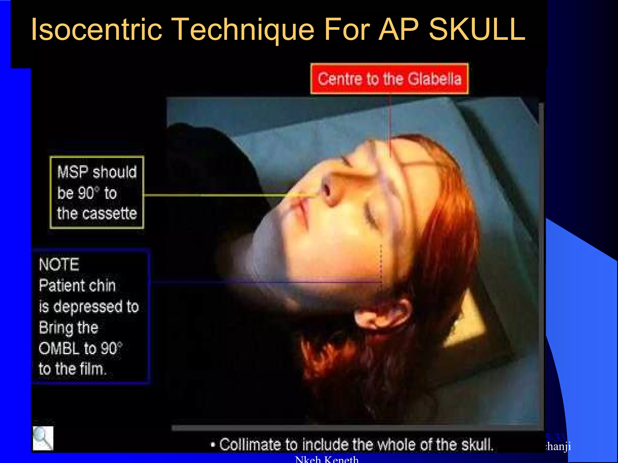 Skull x ray and pathologies radiology training resource nchanji nkeh ...