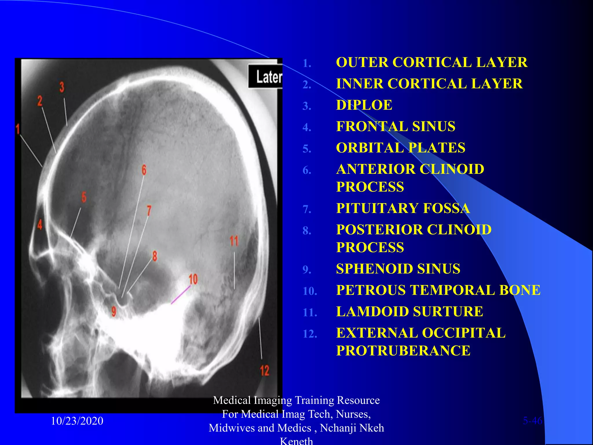 Skull x ray and pathologies radiology training resource nchanji nkeh ...