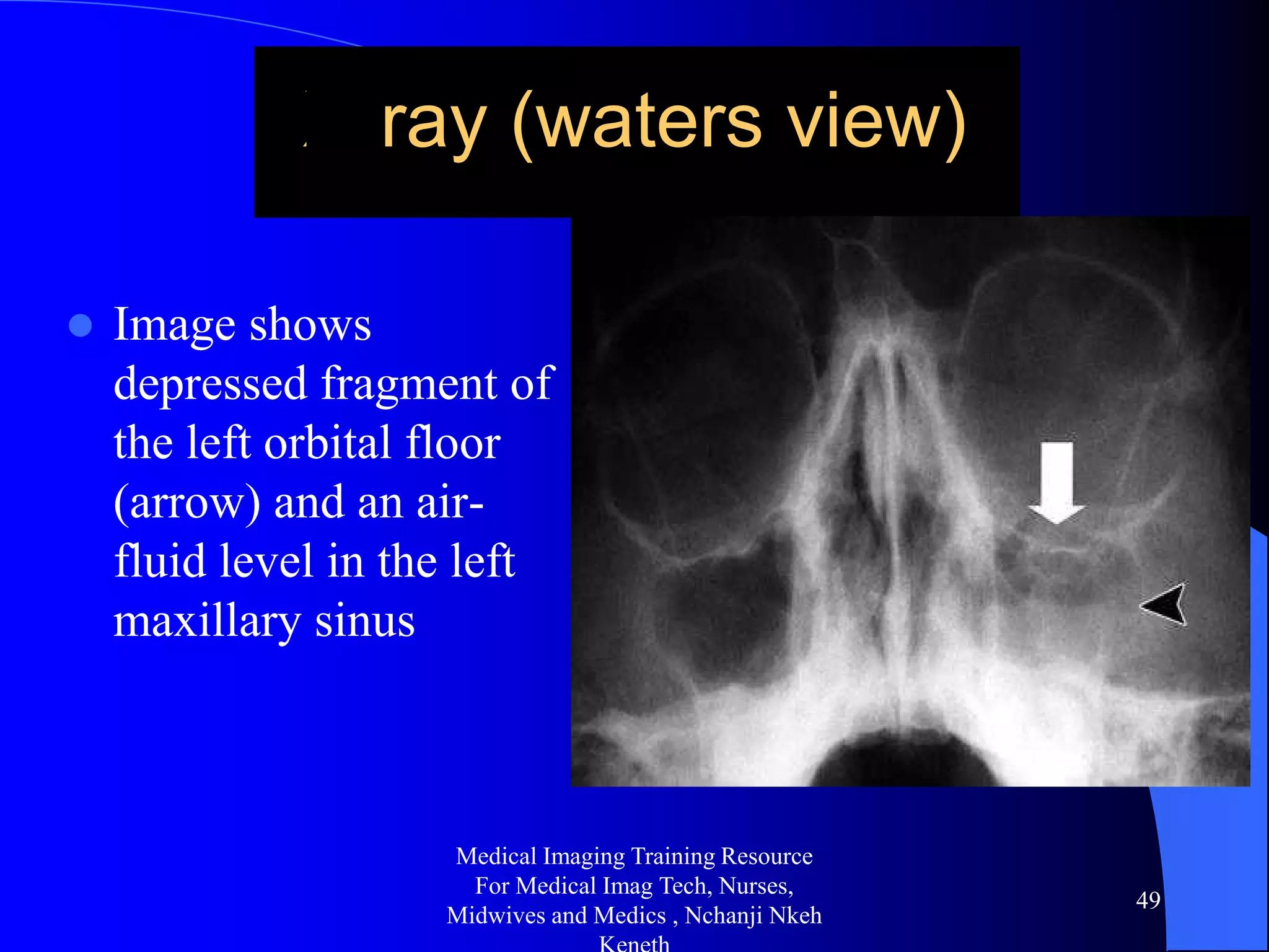 Skull x ray and pathologies radiology training resource nchanji nkeh ...