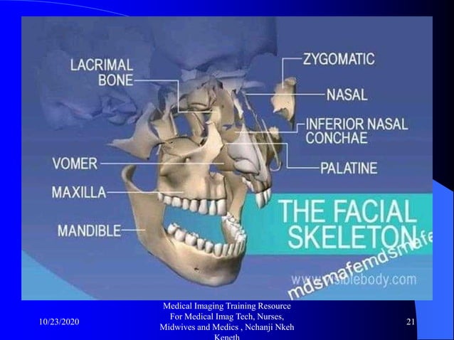 Skull x ray and pathologies radiology training resource nchanji nkeh ...